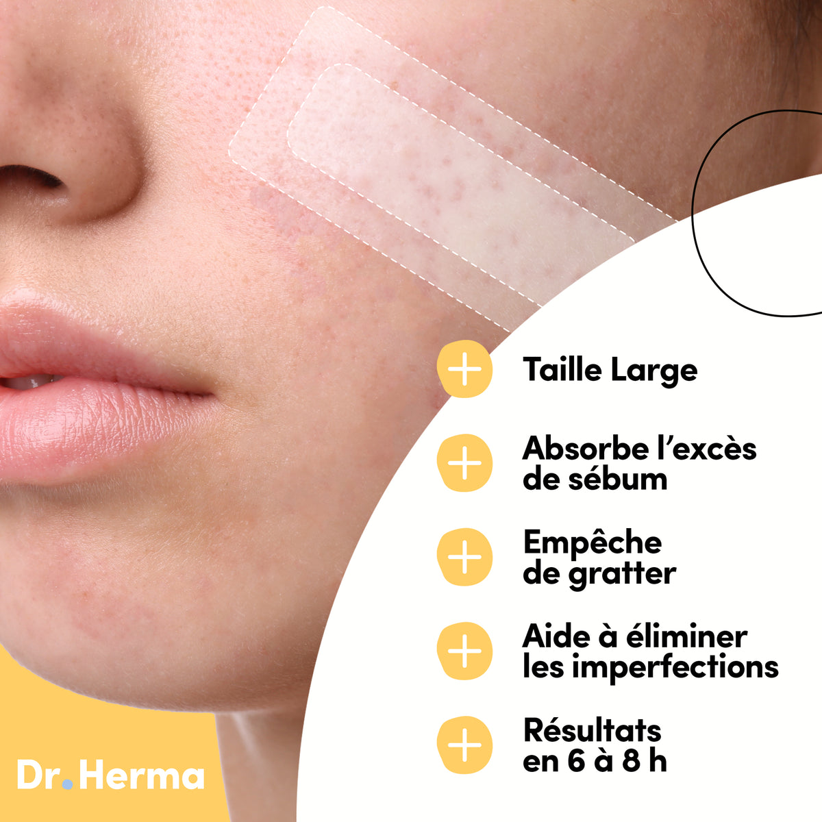 Patch hydrocolloïde & acide salicylique - Anti-acné | Dr Herma